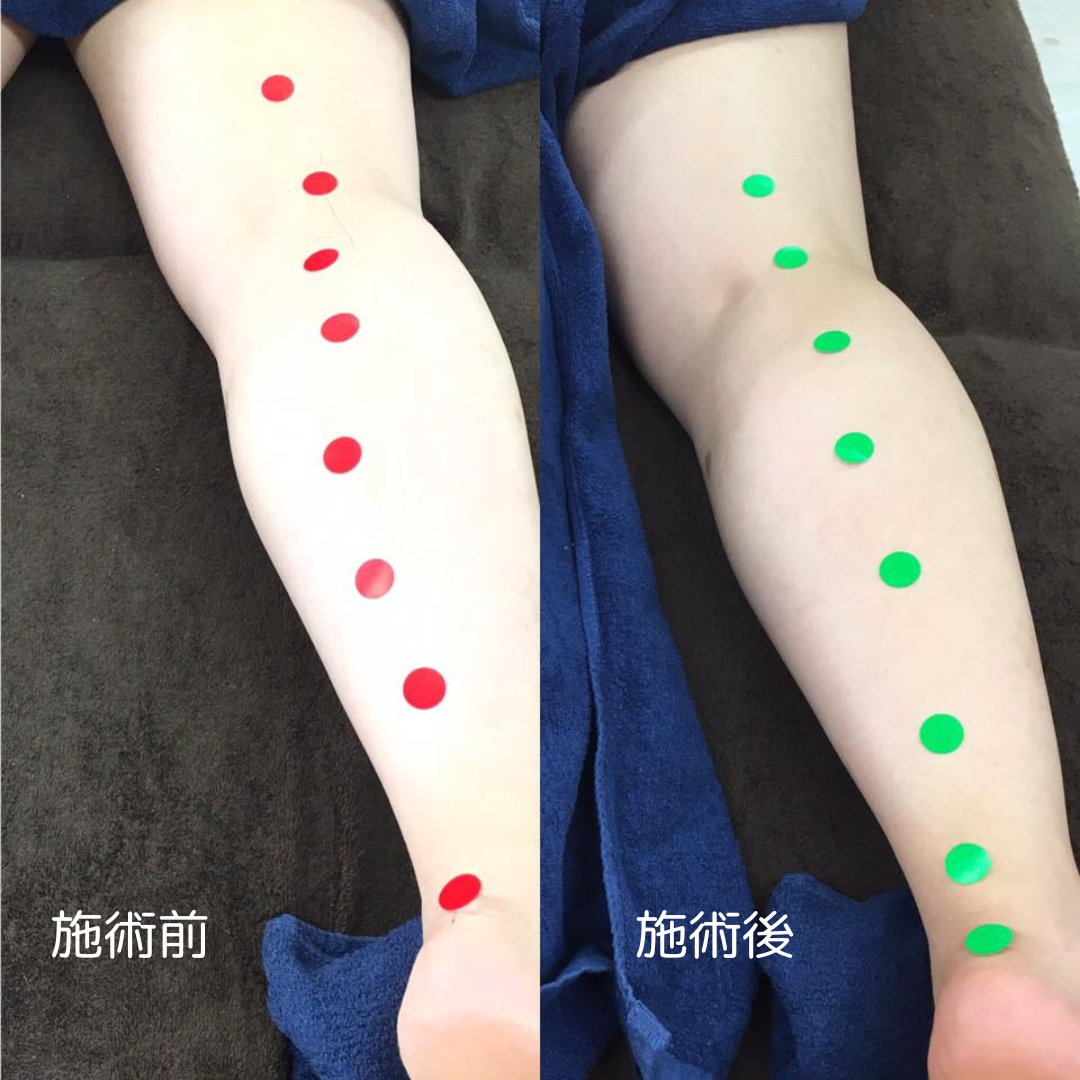 「ゆがみを整える」×「気持ちいい」筋膜リリース ｜ アロマルームアンノン | 茅ヶ崎 | アロマ | リラクゼーション | アロマトリートメント | アロマサロン | アロマテラピー